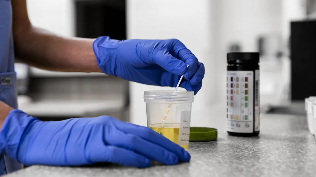 Does DOT Physical Drug Test In 2022 Recruitbros Does DOT Physical Drug Test In 2022 Recruitbros